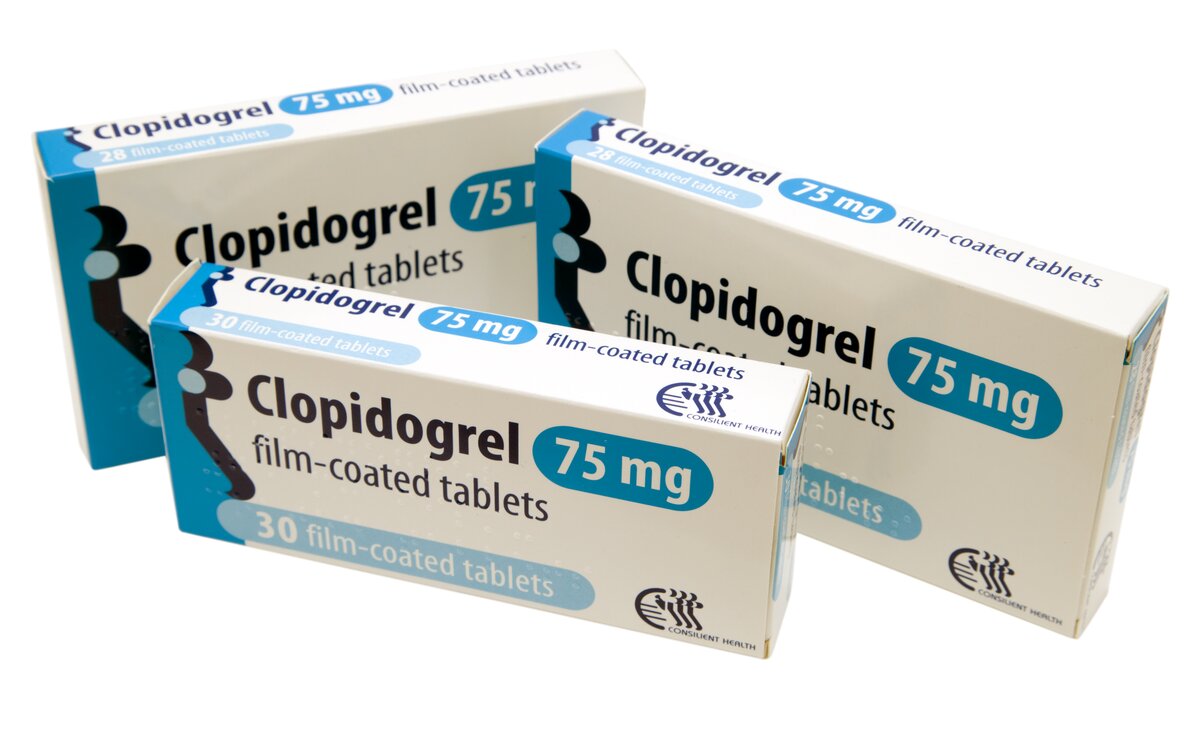 BJCP publishes new Clopidogrel guideline, recommending pharmacogenetic ...